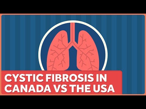 Cystic Fibrosis, Life Expectancy, and the Greatest Health Care System in the World
