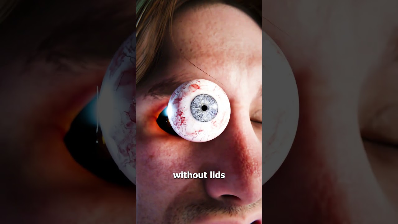 What Happens If You Lose Your Eyelids? 😵