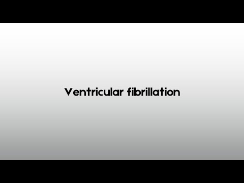 How to pronounce Ventricular fibrillation