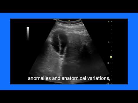 Rare Gallbladder Anomaly: Septate Gallbladder/ Partial Duplication Explained: Ultrasound Findings