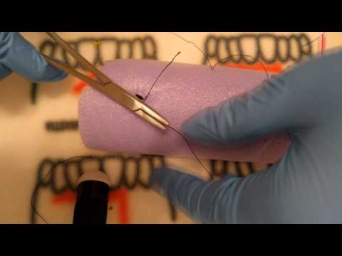 How to perform transfixion stitch to bleeding point. – W.FU's Dental ...