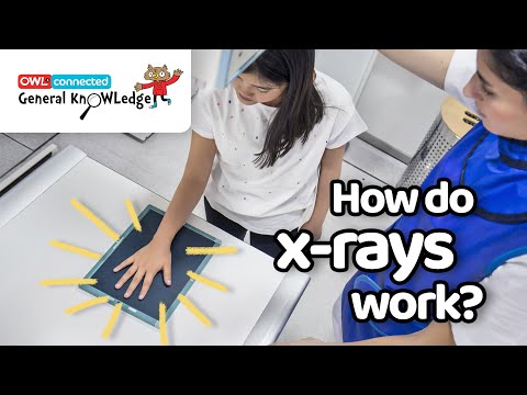 How do x-rays work? | General KnOWLedge
