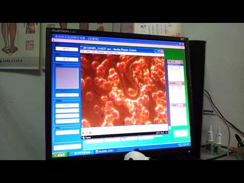 Live Blood Analysis