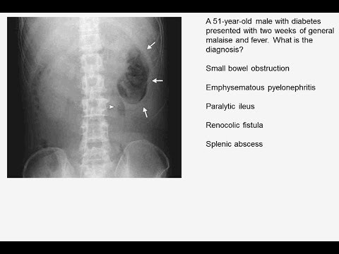 Charité Clinical Journal Club by Fred Luft - 26.10.2016 and 02.11.2016