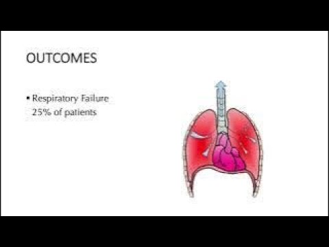 Acute Flaccid Paralysis- 2 . Guillain Barre Syndrome part 1