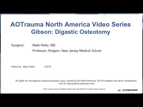 Digastric (Trigastic) osteotomy using a Gibson Approach