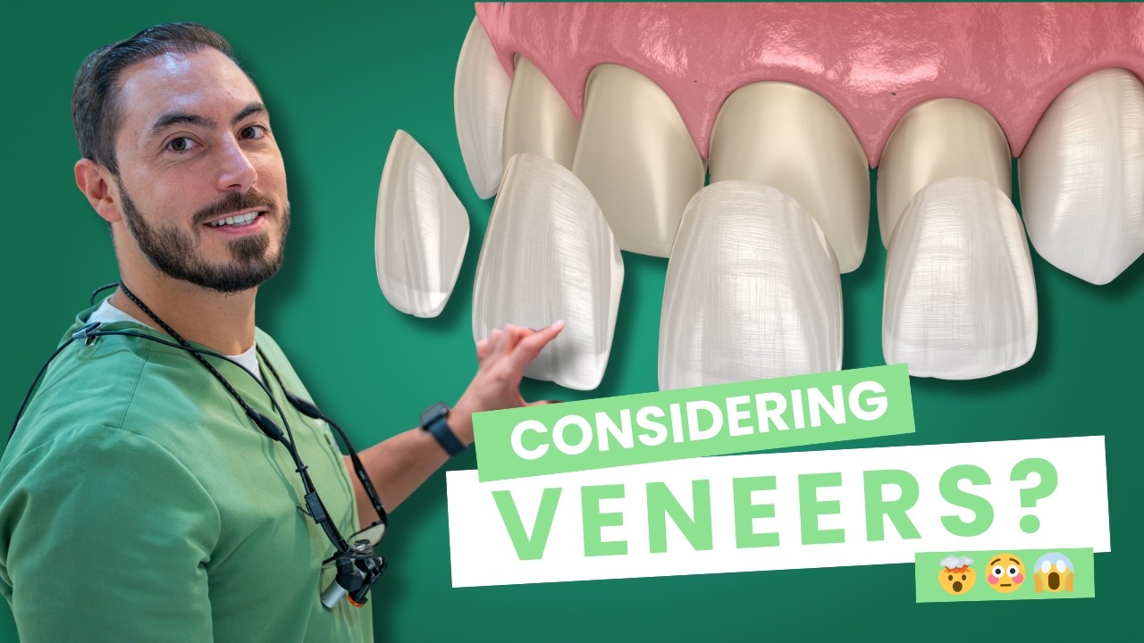 Dental Veneers Procedure Explained | Everything You NEED to Know