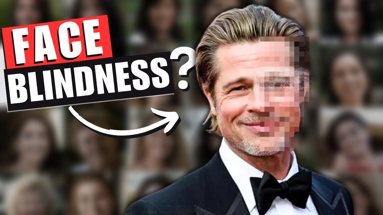 Do You Have Face Blindness!? (Prosopagnosia Explained)