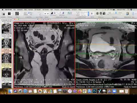 Pelvic Floor Anatomy & Imaging | Part 2