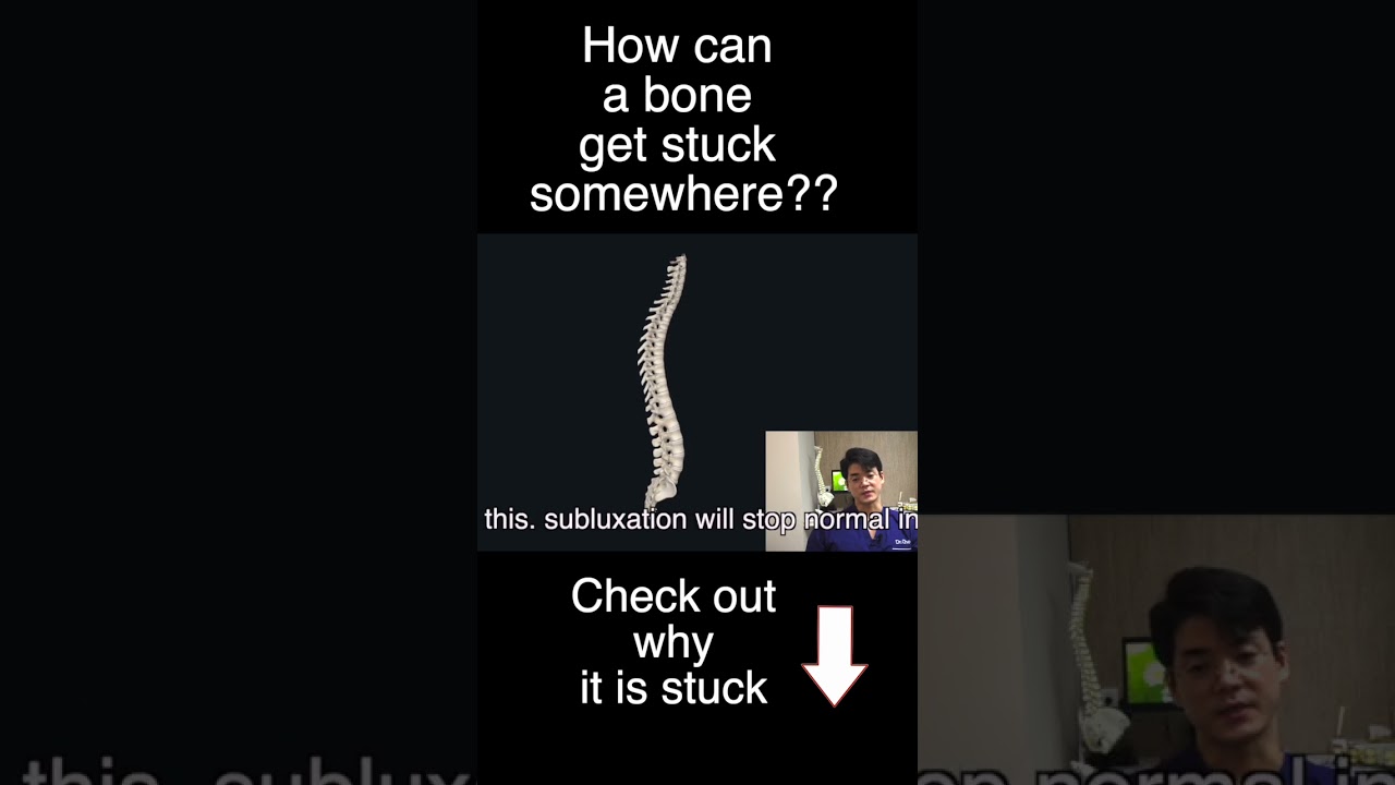 How can you break the vicious cycle from a joint? | Chiropractor in Shanghai