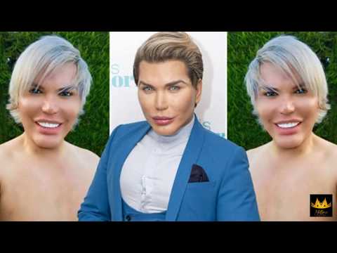 Human Ken Doll Reveals What He Looked Like Before All The Surgery