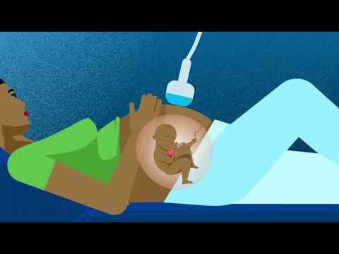 What is a Fetal Echocardiogram? | Children's Hospital Los Angeles