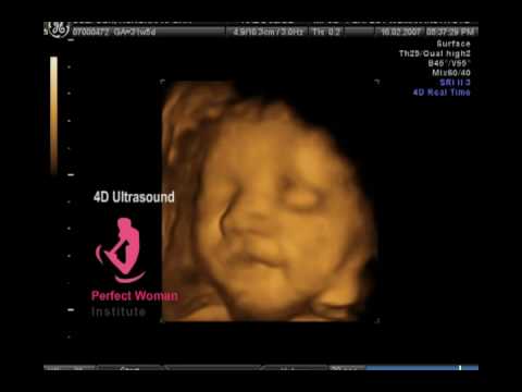 4Dimensional Ultrasound | advancedmedicalcenter