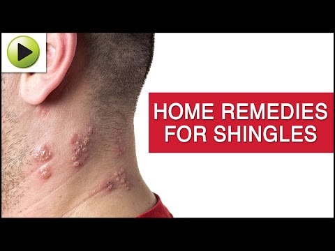 Skin Care - Shingles - Natural Ayurvedic Home Remedies