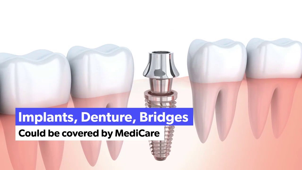 MediCare Part B for Dental Treatments
