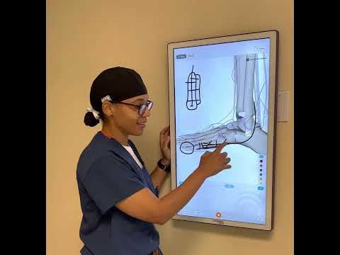 5th Metatarsal Fractures