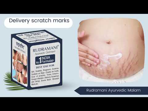 Ringworm Ointment - Ring Worm Latest Price, Manufacturers & Suppliers