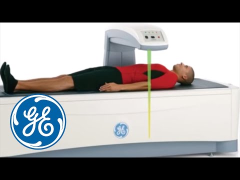 DEXA Bone Densitometer - X Ray Bone Densitometer Latest Price ...