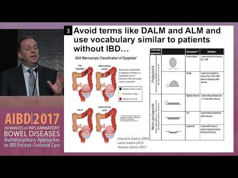Diagnosis and management of dysplasia and polyps in chronic ulcerative colitis