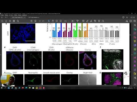 B cells adaptive immunity, alignate, fibrosis, macropahge and B cells