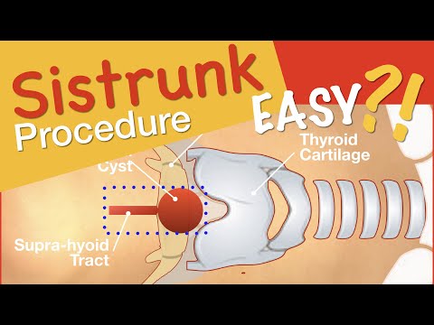 Sistrunk Procedure (Thyro-glossal Cyst Excision) - Pediatric Surgery Club
