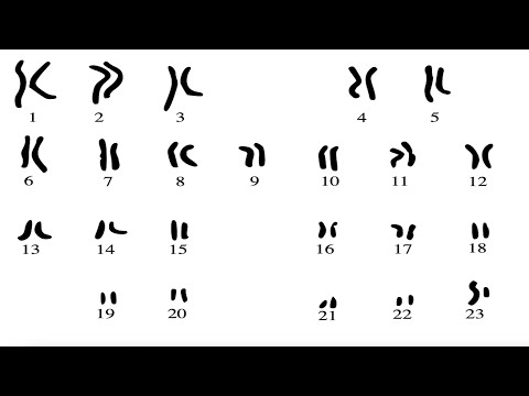 Are Males Destined to Disappear Due to a Weak Y Chromosome?