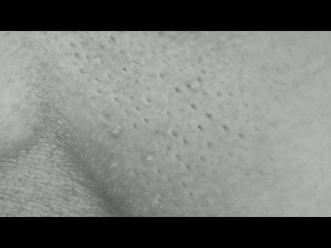How to draw realistic skin texture | drawing skin texture made easy