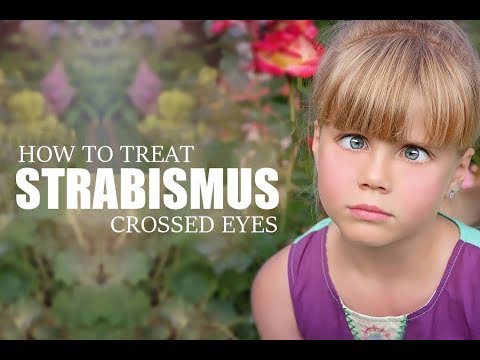 Crossed Eyes and Strabismus Treatments