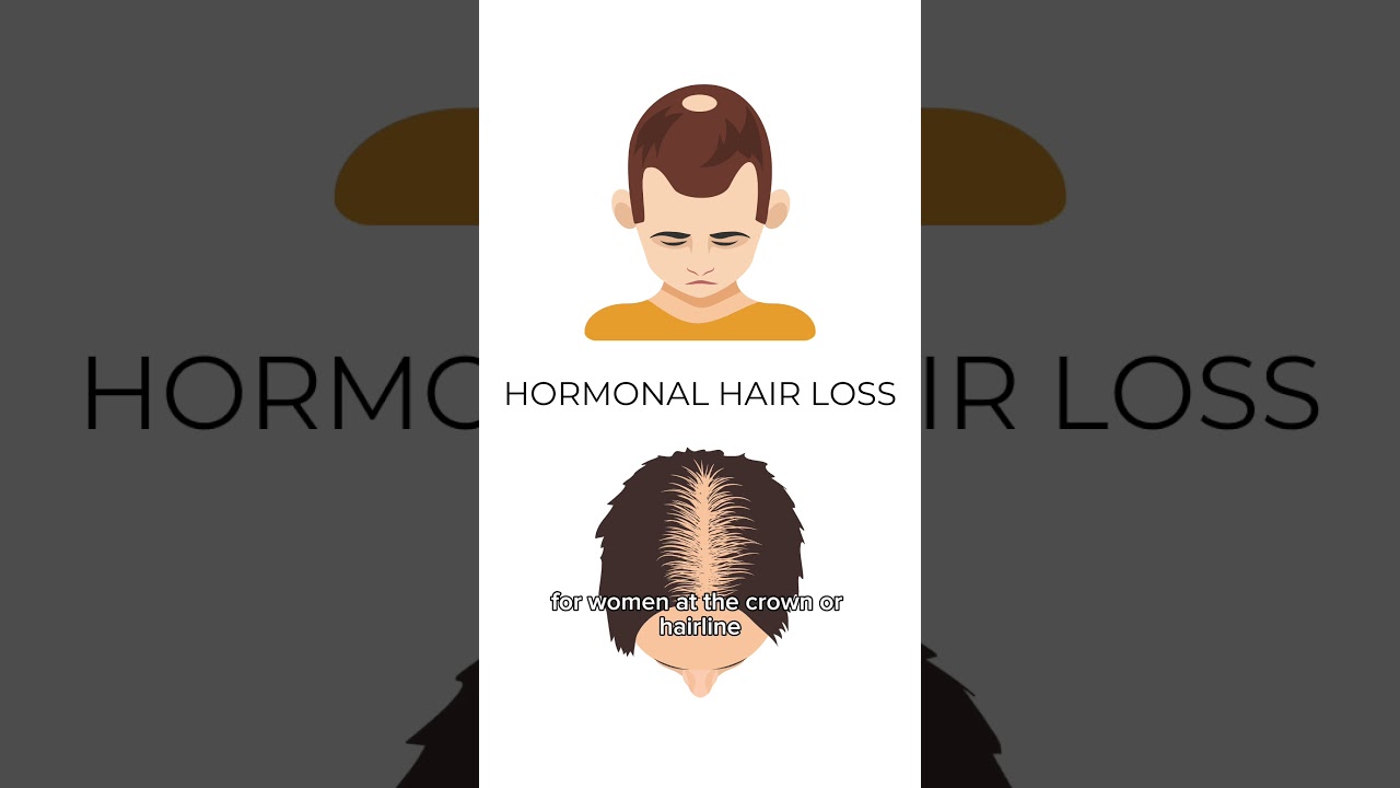 How to know what TYPE of HAIR LOSS you have | #hairloss #alopecia