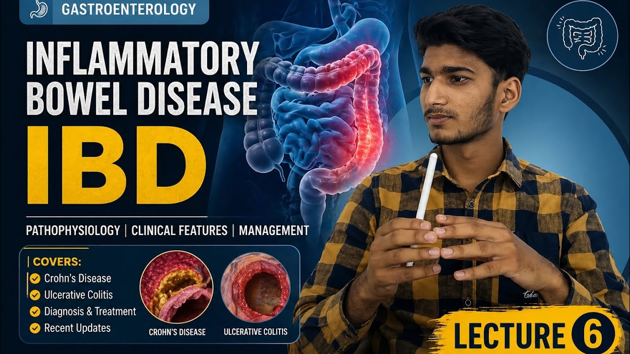 Gastroenterology topic:- IBD