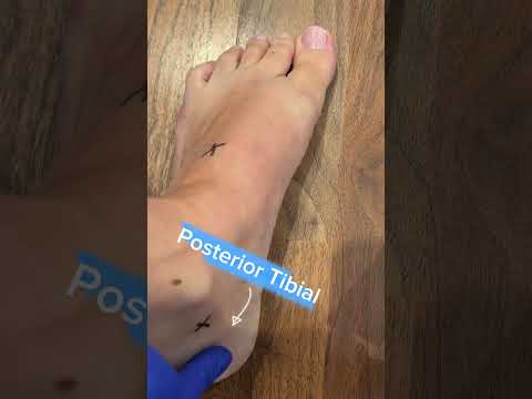 Nursing skills: Assessing distal pulses