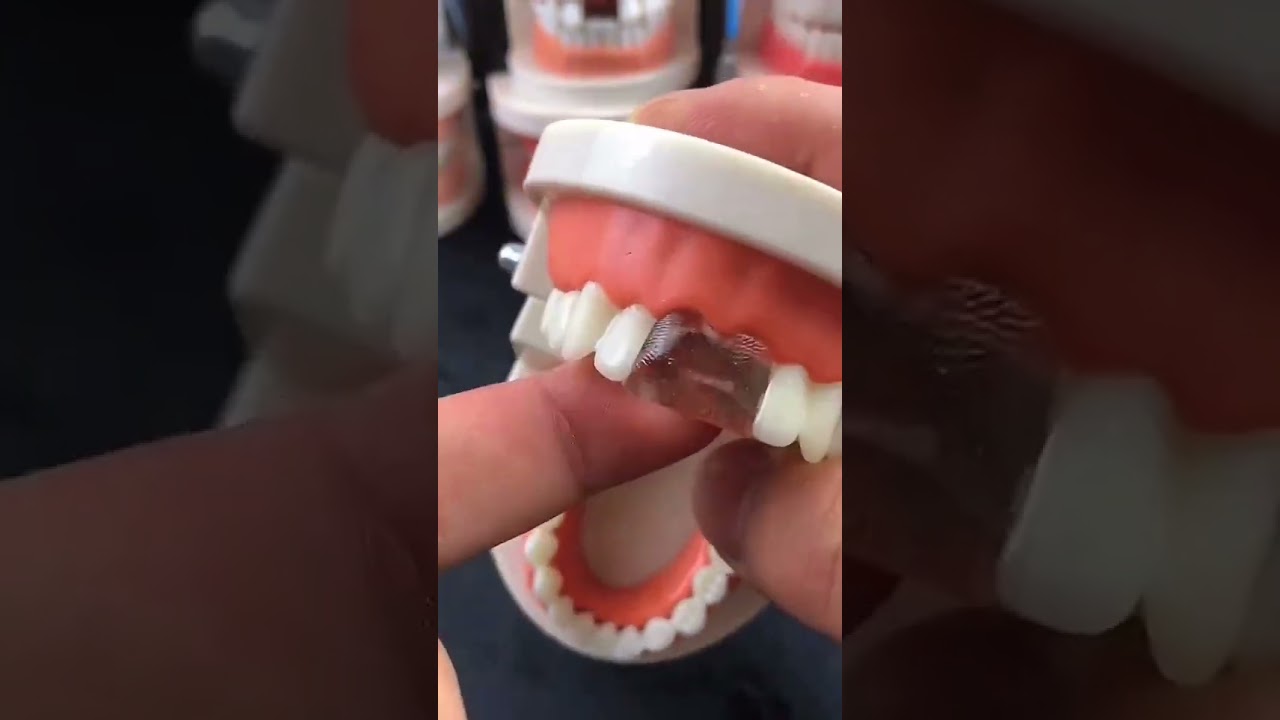 False teeth Molder Repair Gap Tooth, craps#🦷#bead#repair#cheap#savemoney#fill#fix#tooth