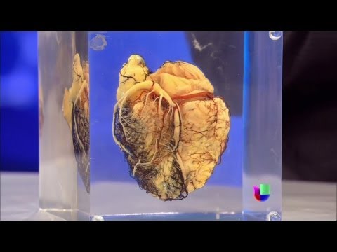 How does a heart attack occur?