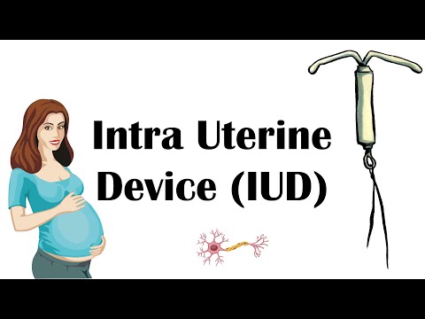 Intra Uterine Contraceptive Device (IUCD/IUD) - Types, Uses, Contraindications, & Complications
