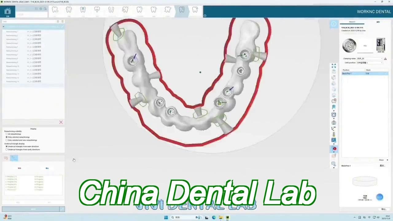ivoclar digital dental crowns process noritake porcelain high accuracy