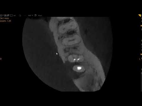 YP - Dr. AN