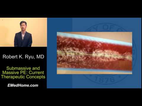 Paradigm Shift: New Technology for Treatment of Acute Pulmonary Embolism, Lecture 1