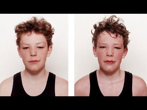 Before and After a Boxing Bout- In Pictures – The View from Inside and ...