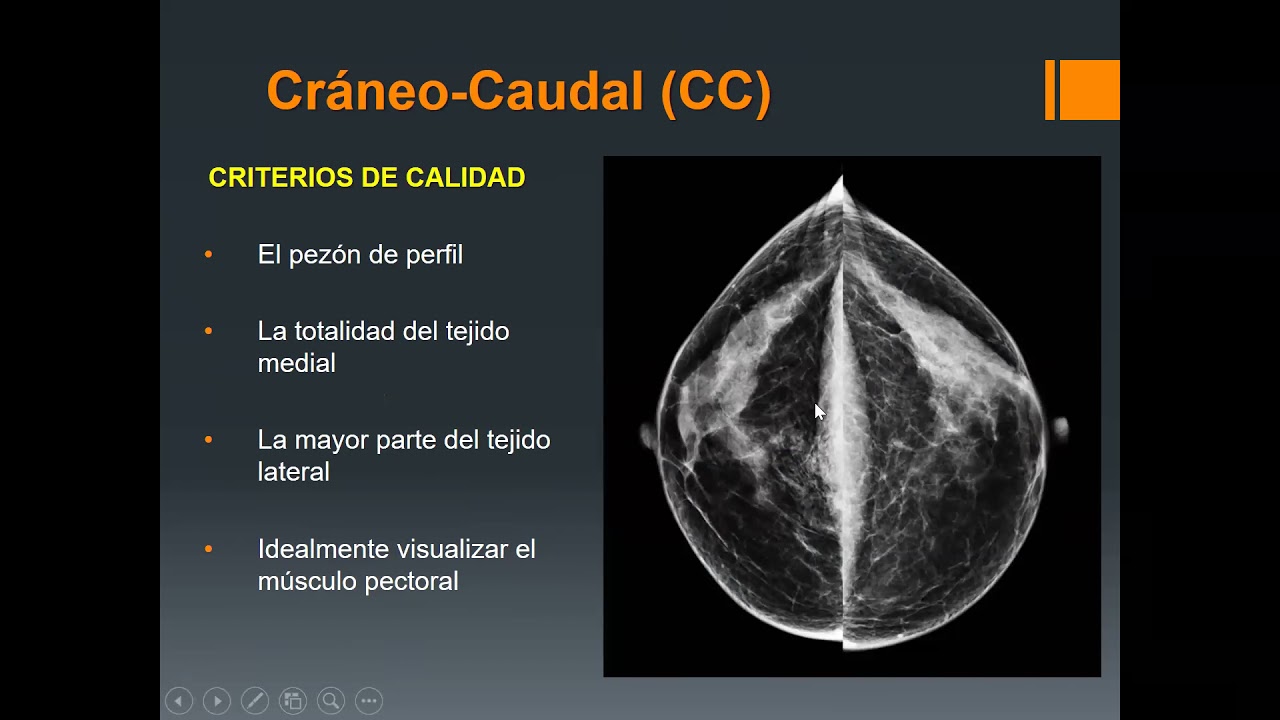 Clase CuCo - Anatomia de la mama