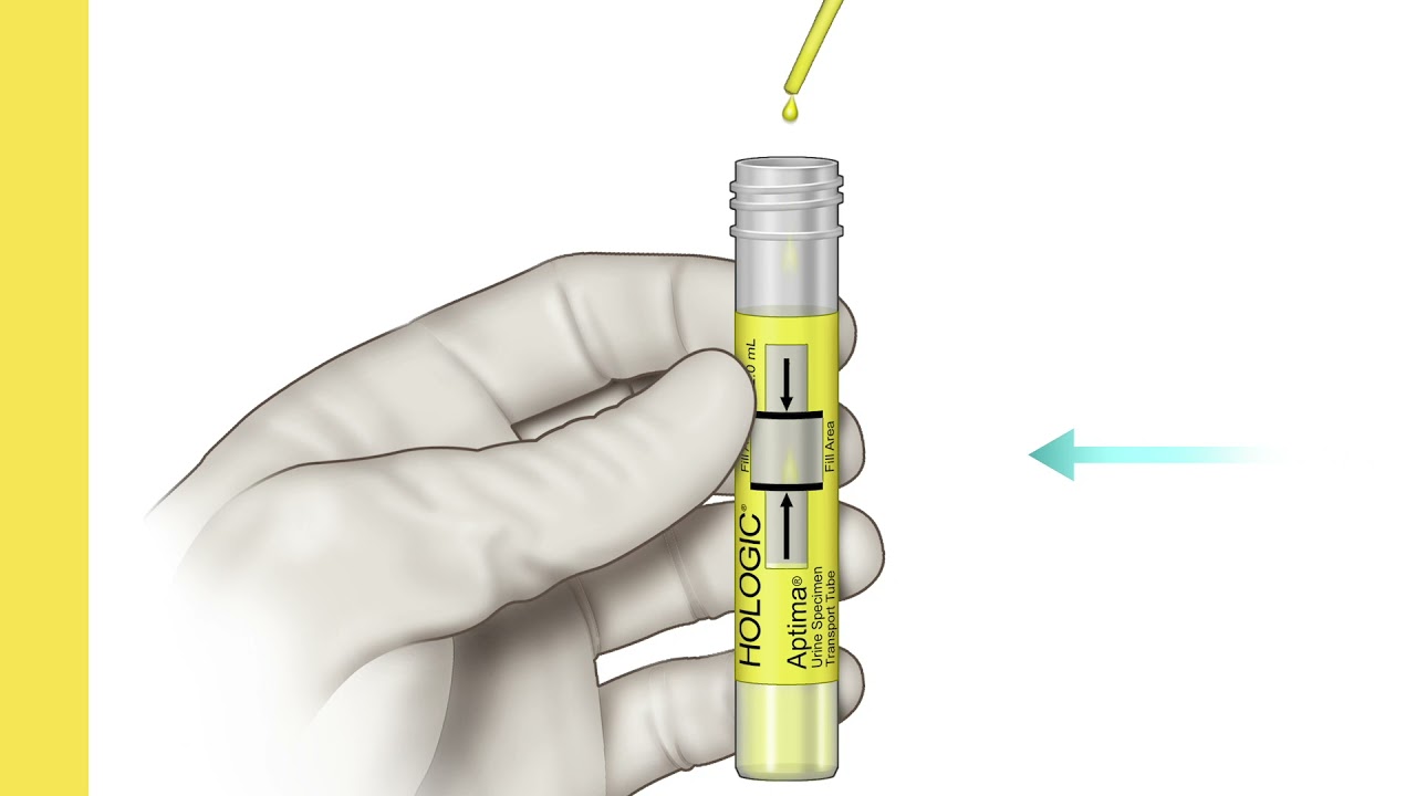 Aptima® Urine Collection Kit – Collection Procedure Guide