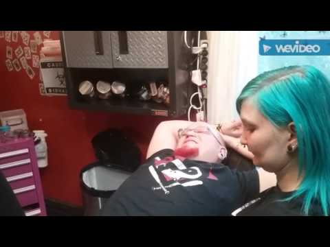 Multiple scrotal piercing reaction