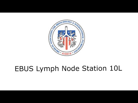 EBUS Lymph Node Station 10L