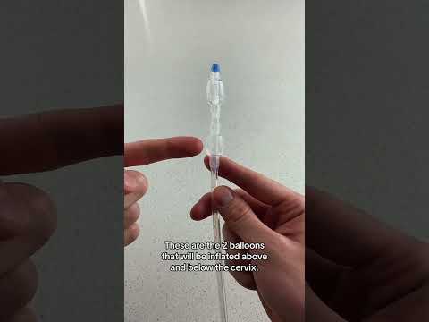 How Labor Is Induced (Pregnancy Induction Methods) - Cervical Ripening Cook Balloon