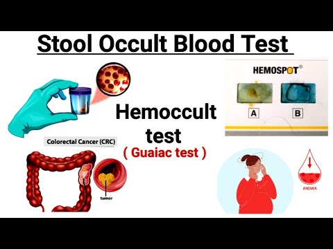 Stool for occult blood test || Hemoccult test || Guaiac test || FOBT