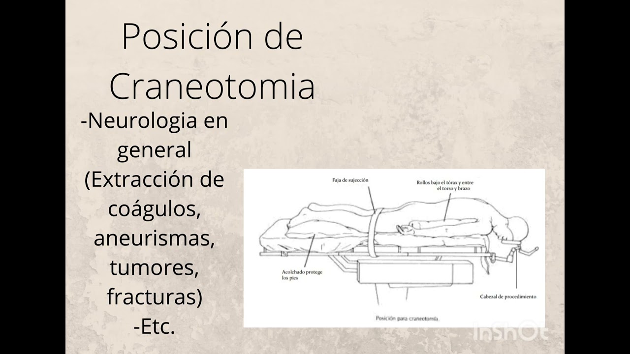 POSICIONES QUIRURGICAS