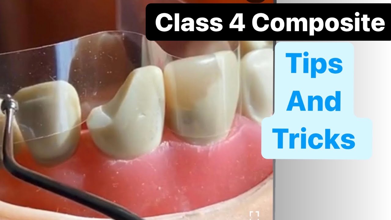 CLASS 4 COMPOSITE- TIPS and TRICKS