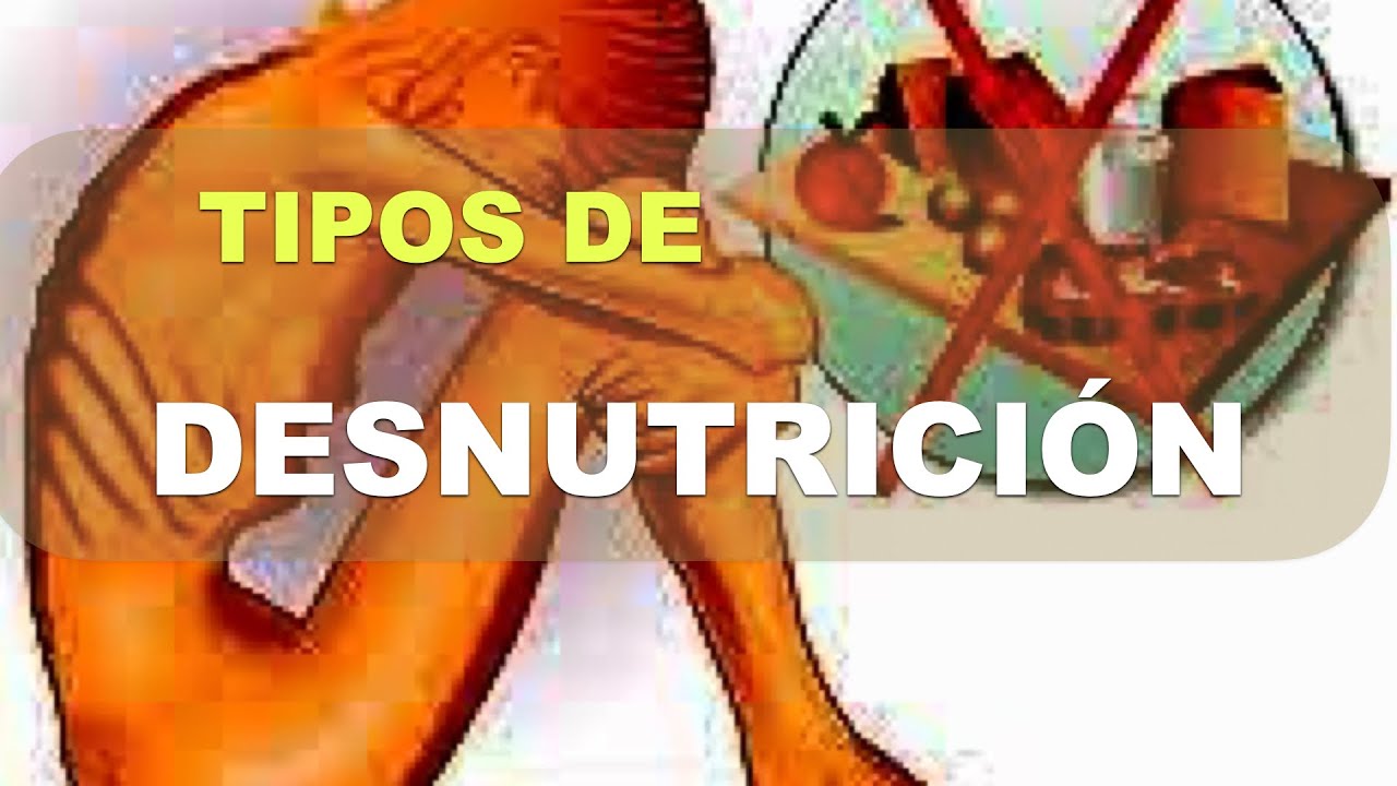 Tipos de Desnutrición