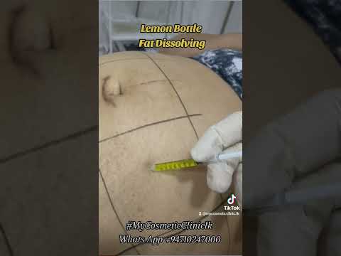 Lemon Bottle Fat Dissolving Treatment #mycosmeticcliniclk #youtubeshort