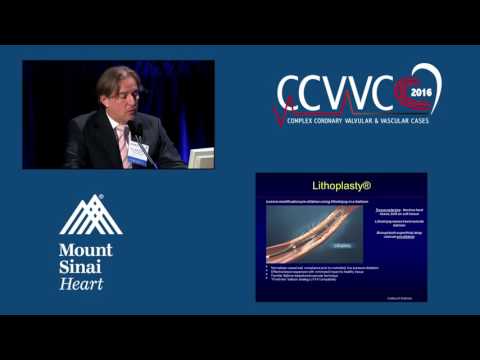 New Technologies for the Treatment of PAD?