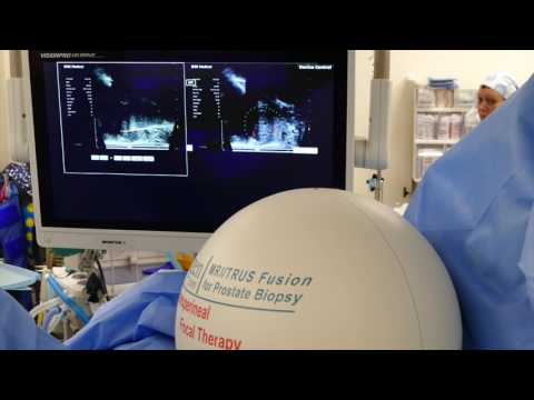 Artemis - The Prostate Clinic